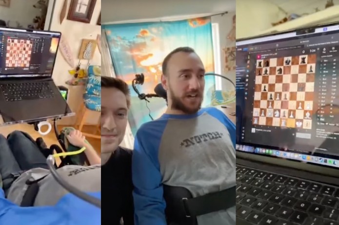 Miyasiga “Neuralink” implanti o‘rnatilgan odam qurilmaning ishlashi ...